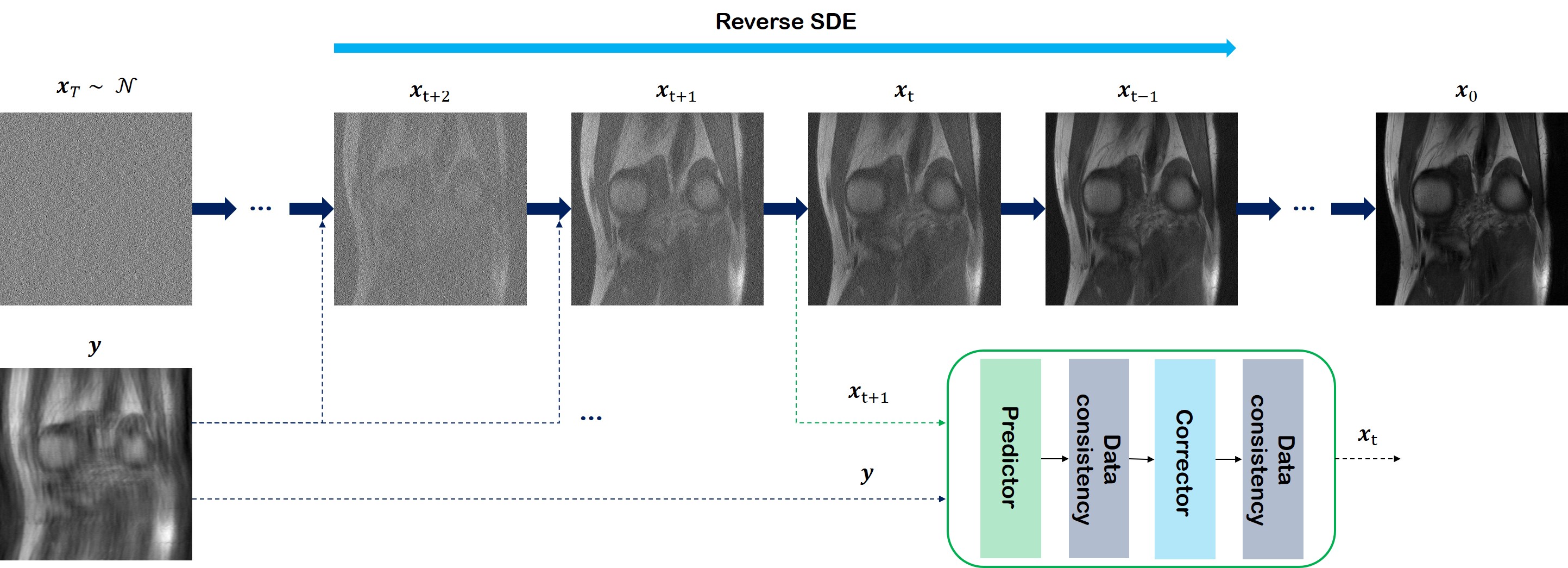 Score-based diffusion models for accelerated MRI | hj-chung Score-based diffusion models for accelerated MRI | hj-chung