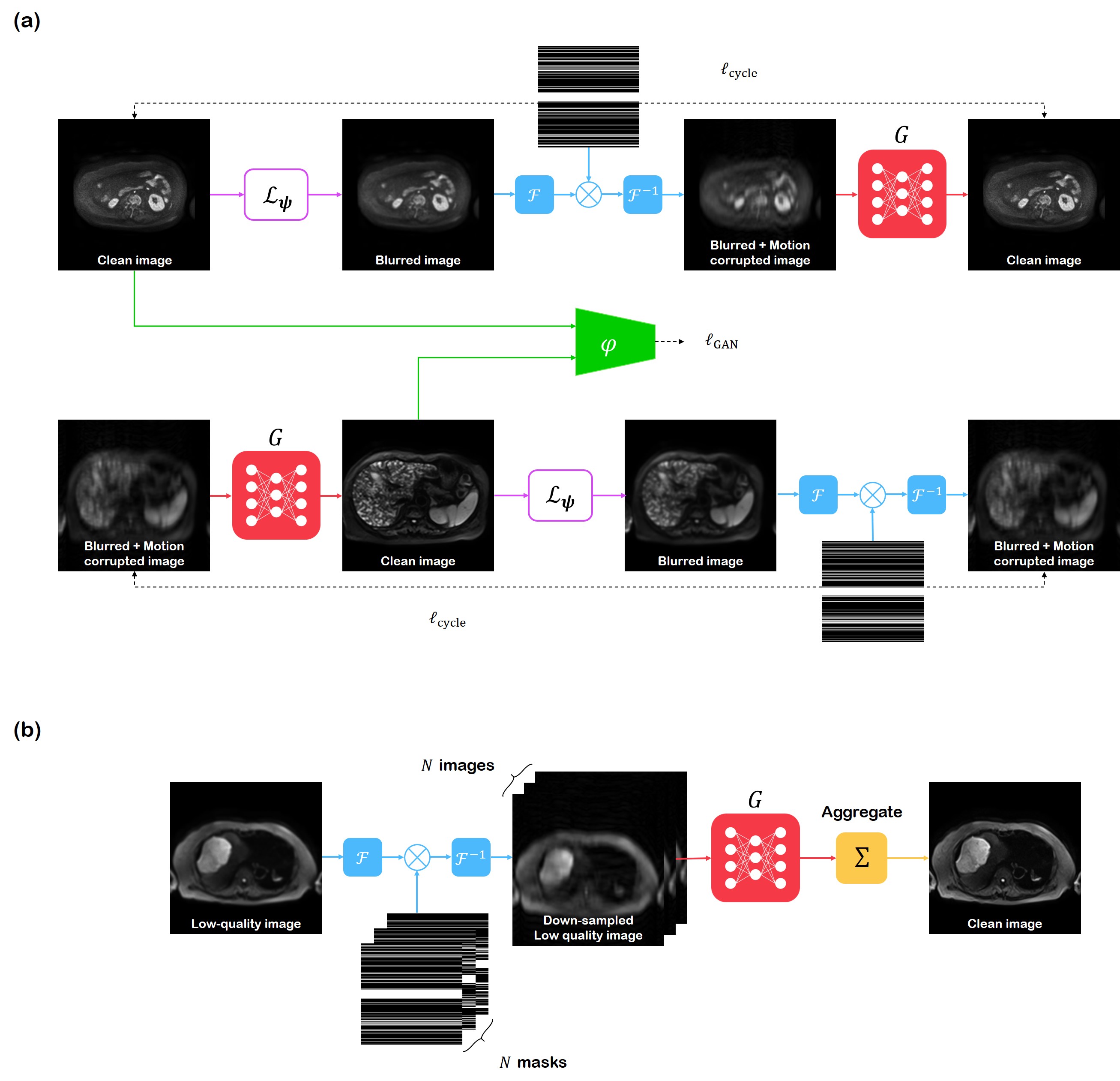 Simultaneous super-resolution and motion artifact removal in diffusion ... Simultaneous super-resolution and motion artifact removal in diffusion ...